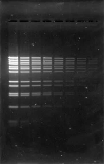 DNA and RNA Gel Documentation with the Odyssey Imagers