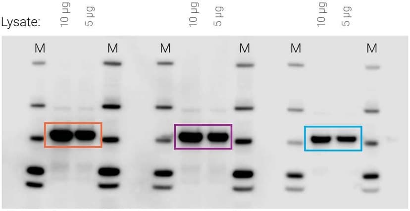 Perform Replicate Analysis for Reliable Western Blot Data
